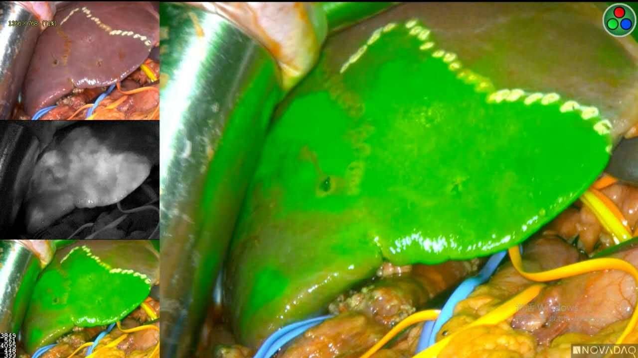 荧光视野下的精准肝胆外科_h5页面制作工具_人人秀H5_rrx.cn